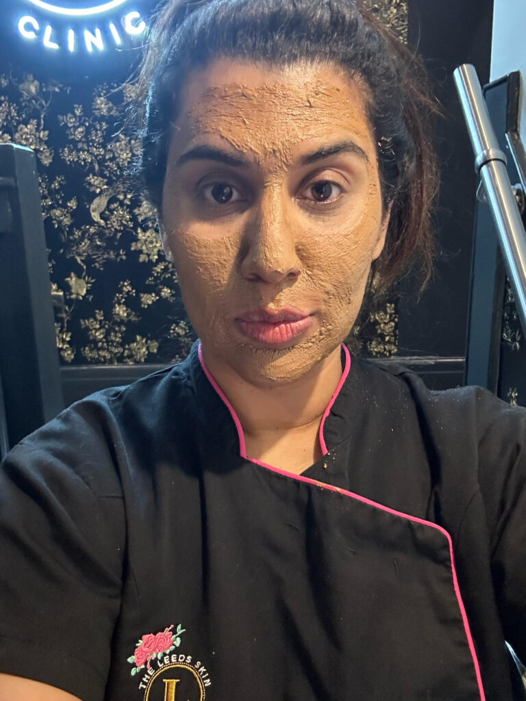 It’s Officially Peel Season - The Leeds Clinic